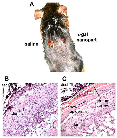 Accelerated Burn Healing in a Mouse Experimental Model Using α-Gal ...