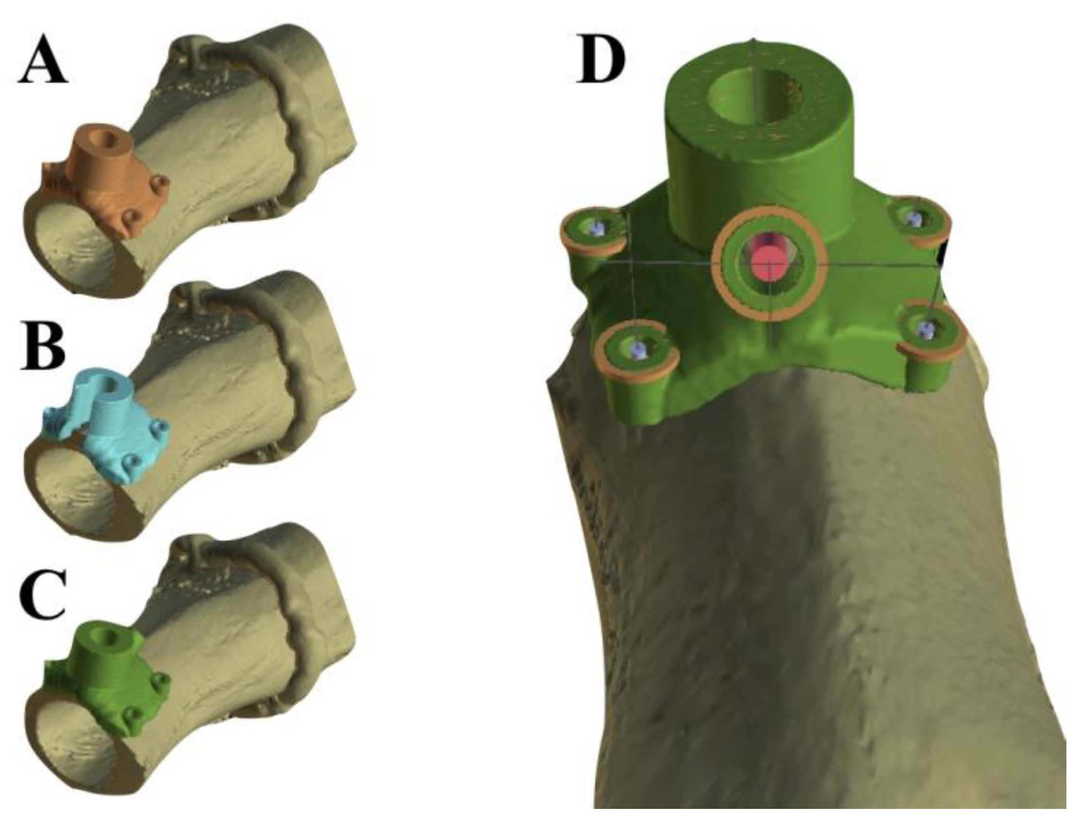 The 3D Printing and Evaluation of Surgical Guides with an Incorporated ...