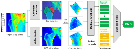 Bioengineering | Free Full-Text | Enhancement of Hip X-ray with Convolutional Autoencoder for ...