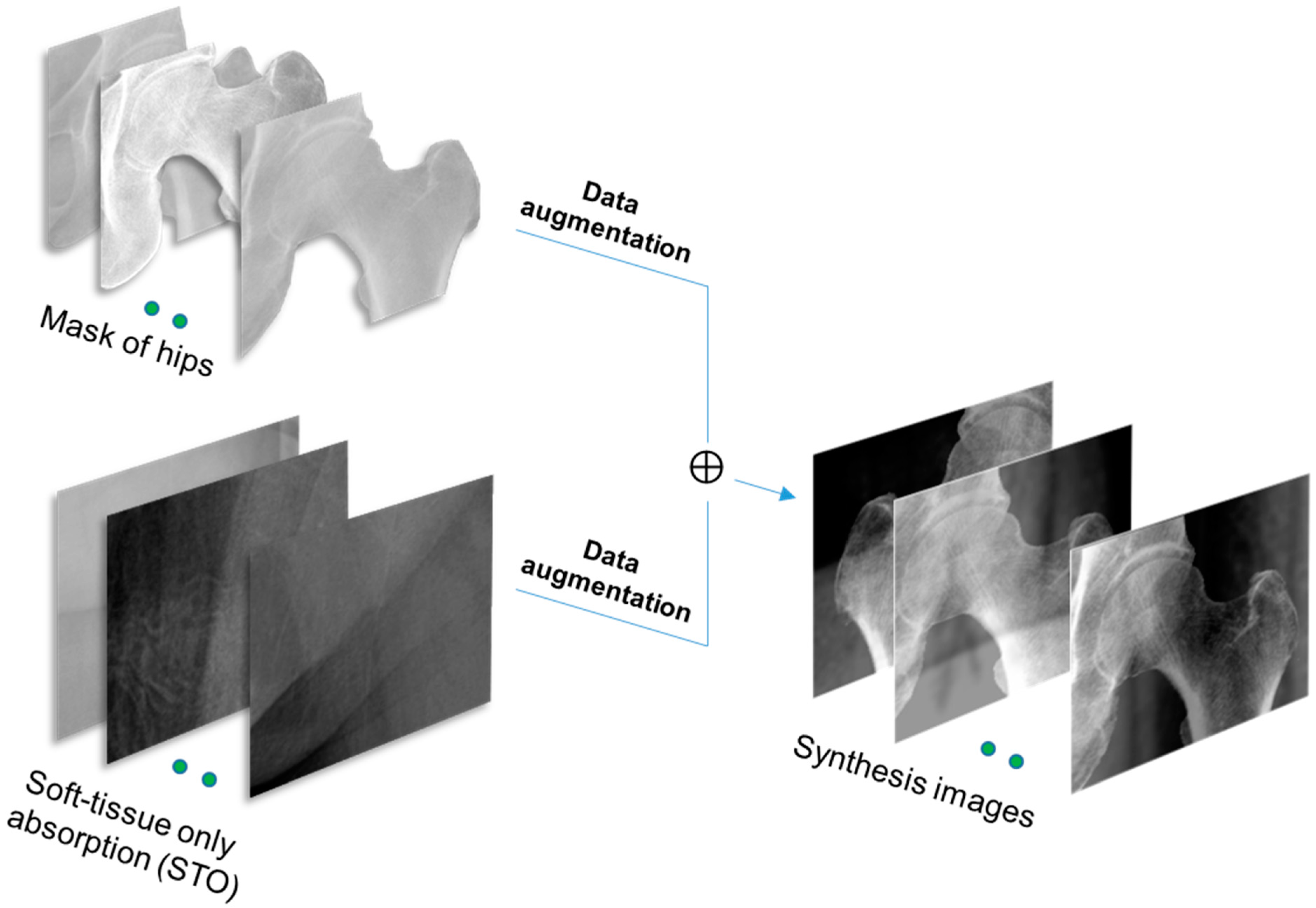 Bioengineering | Free Full-Text | Enhancement of Hip X-ray with ...