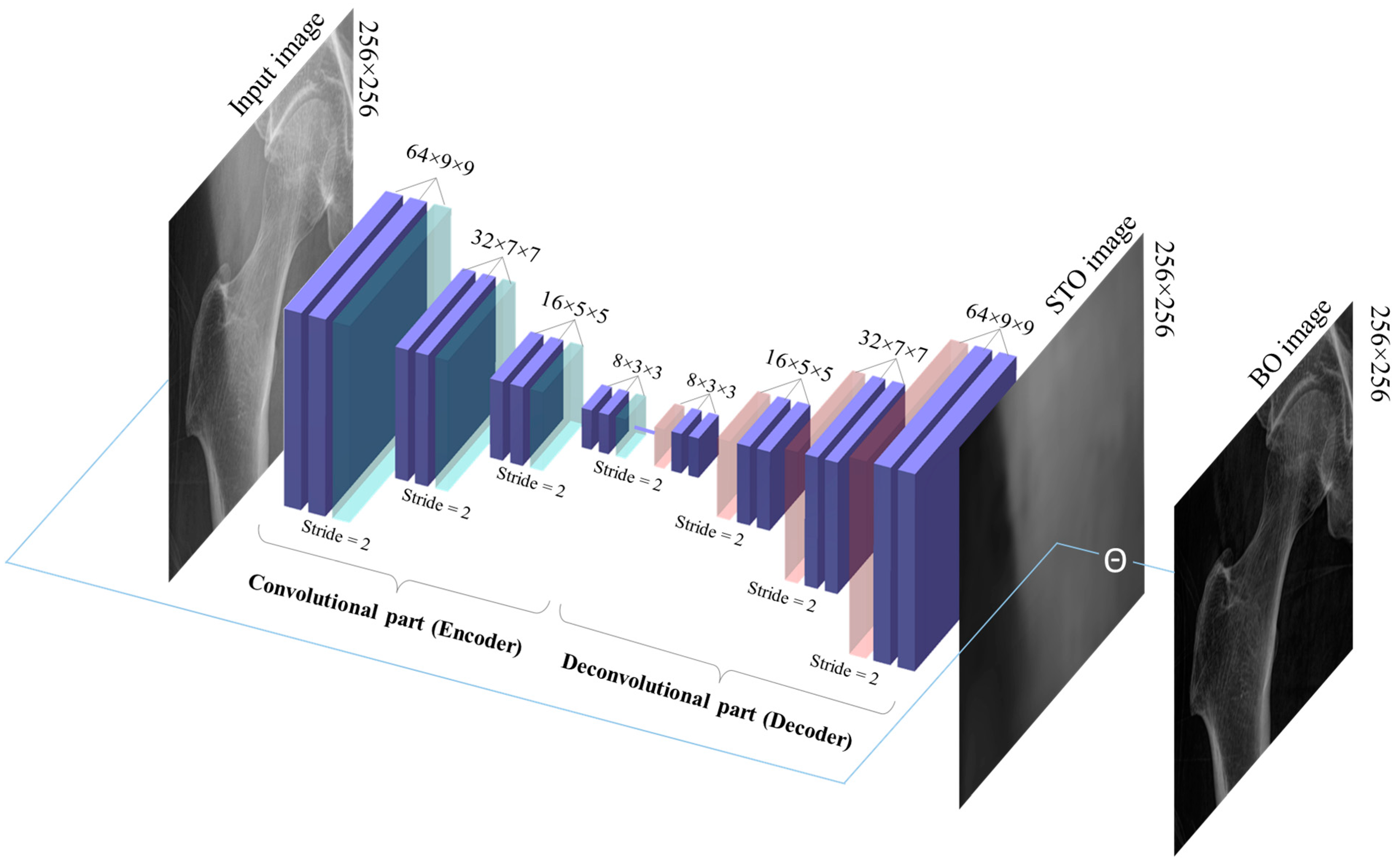 Bioengineering | Free Full-Text | Enhancement of Hip X-ray with Convolutional Autoencoder for ...