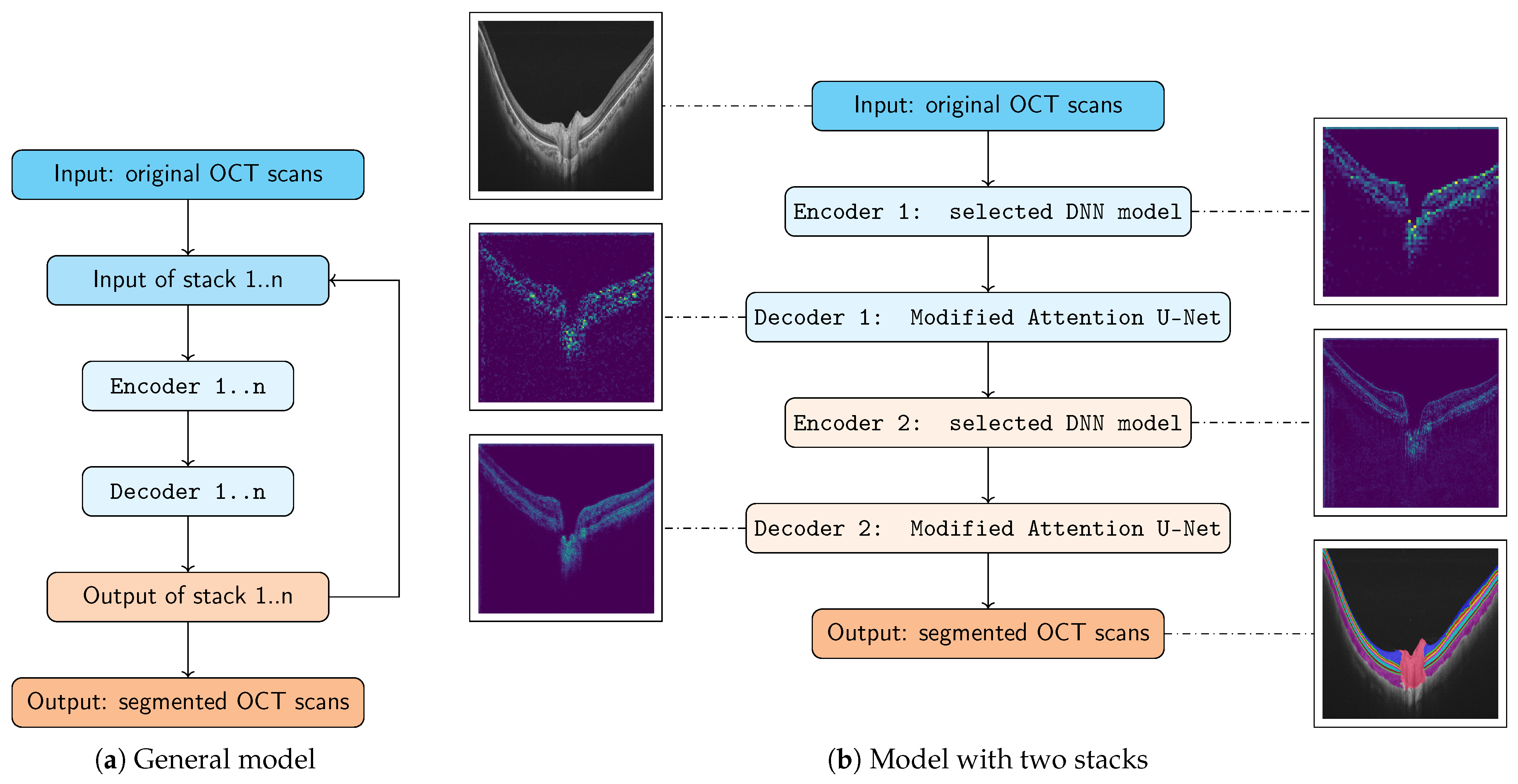Improving OCT Image Segmentation of Retinal Layers by Utilizing a Machine Learning Based ...