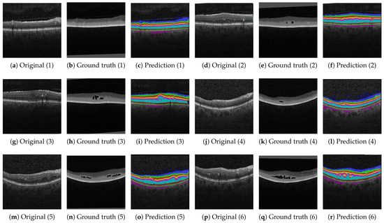 Improving OCT Image Segmentation of Retinal Layers by Utilizing a ...