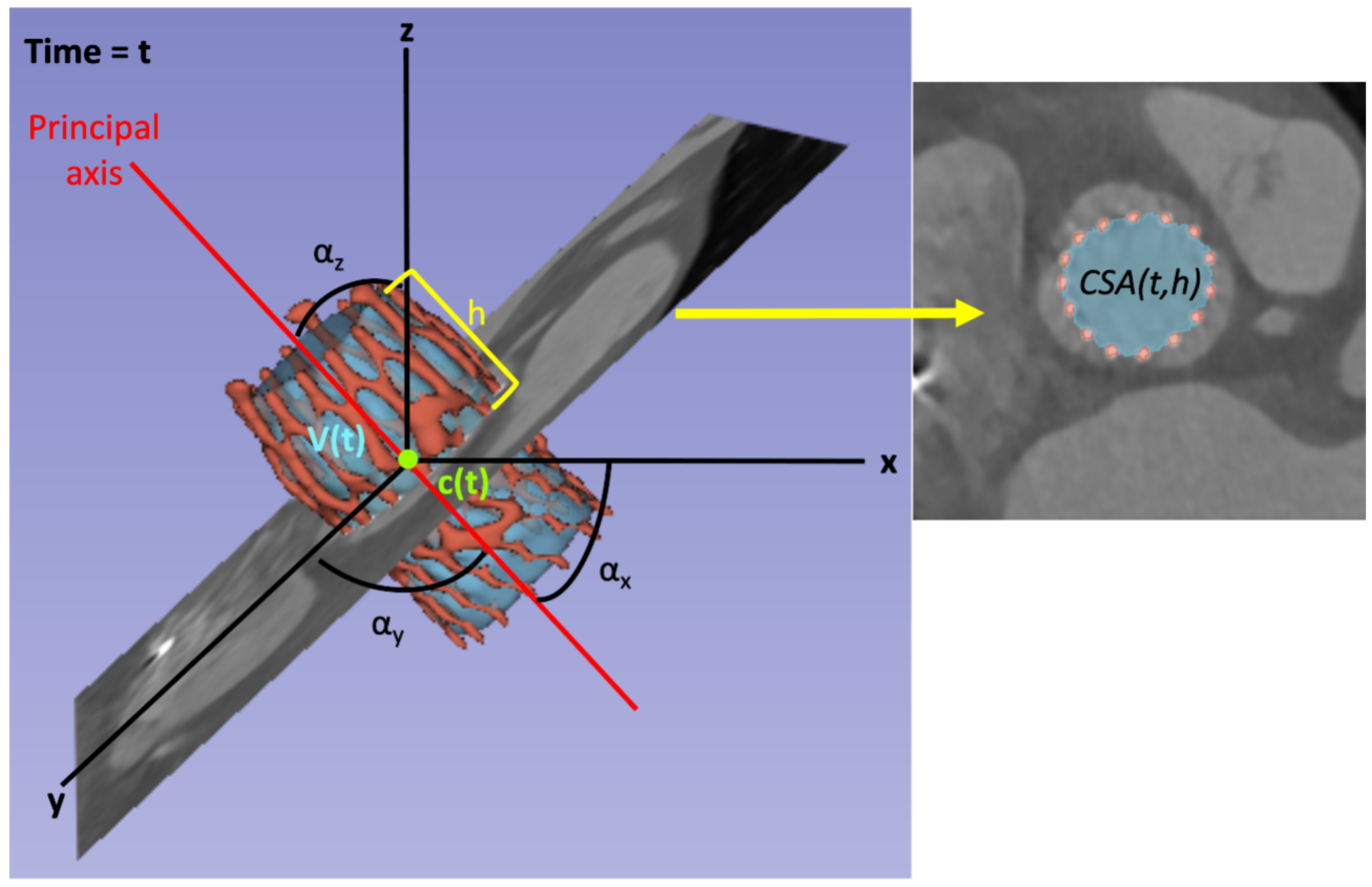 Automatic Assessment of Transcatheter Aortic Valve Implantation Results ...
