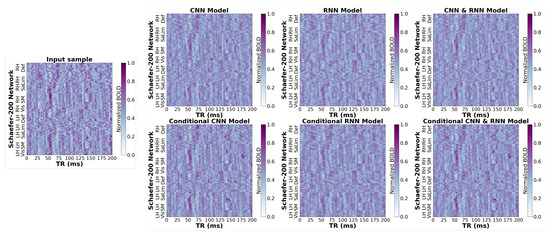 Conditional Variational Autoencoder for Functional Connectivity Analysis of Autism Spectrum ...