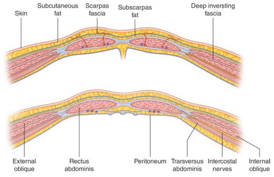 Mechanical Characterization of the Human Abdominal Wall Using Uniaxial ...