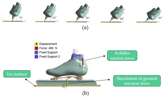 Investigation of the Mechanical Response of the Foot Structure ...