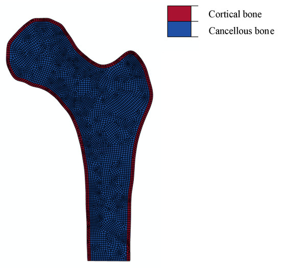 An Analysis of Trabecular Bone Structure Based on Principal Stress ...
