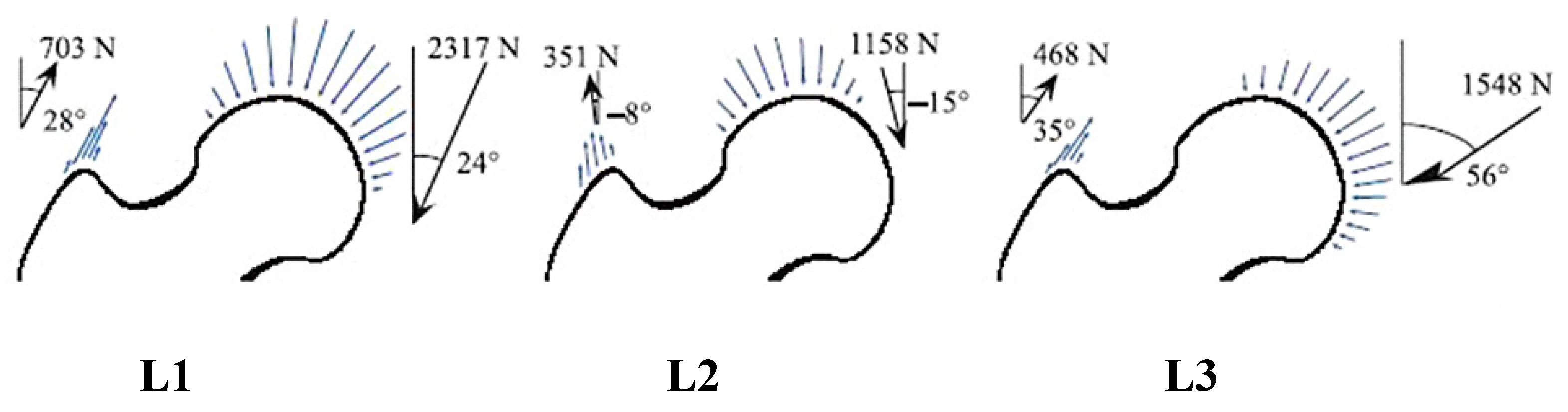 An Analysis of Trabecular Bone Structure Based on Principal Stress ...