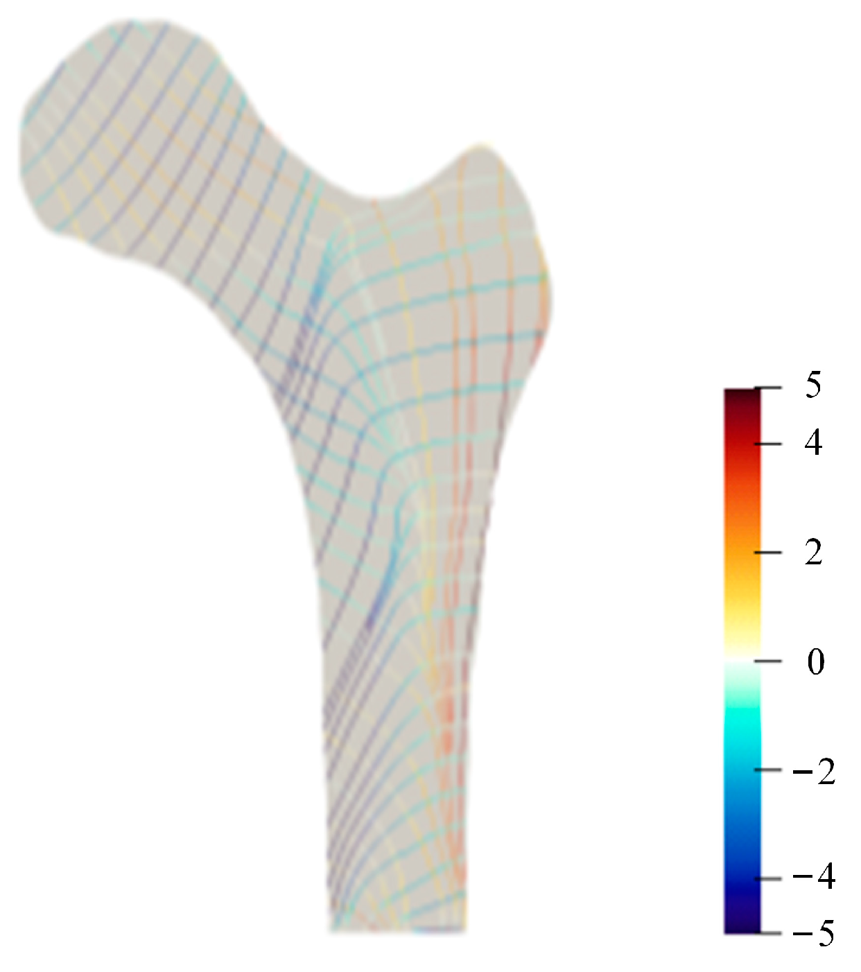 An Analysis of Trabecular Bone Structure Based on Principal Stress ...