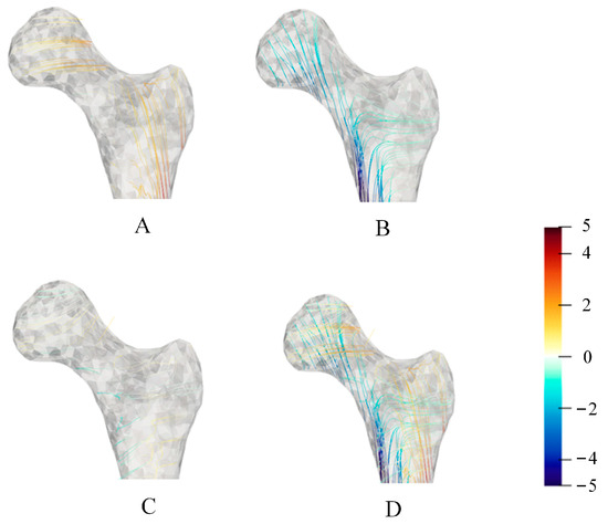 An Analysis of Trabecular Bone Structure Based on Principal Stress ...