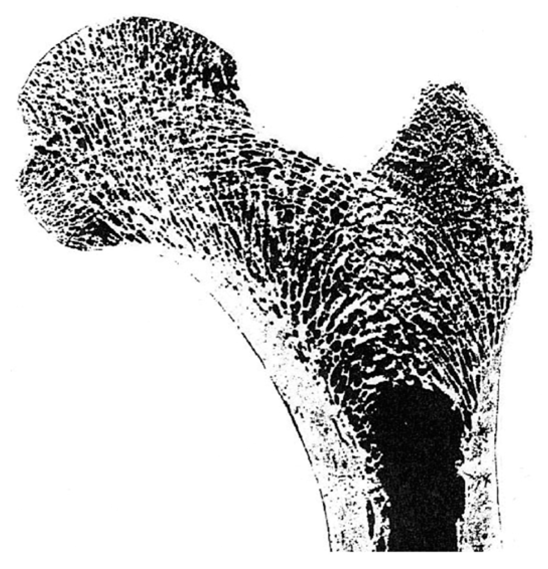 An Analysis of Trabecular Bone Structure Based on Principal Stress ...
