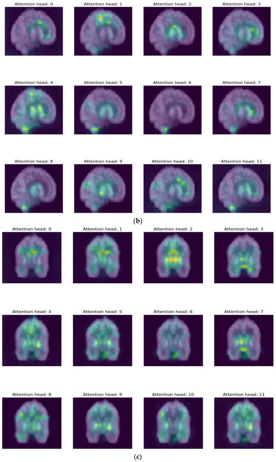 Explainable Vision Transformer with Self-Supervised Learning to Predict ...