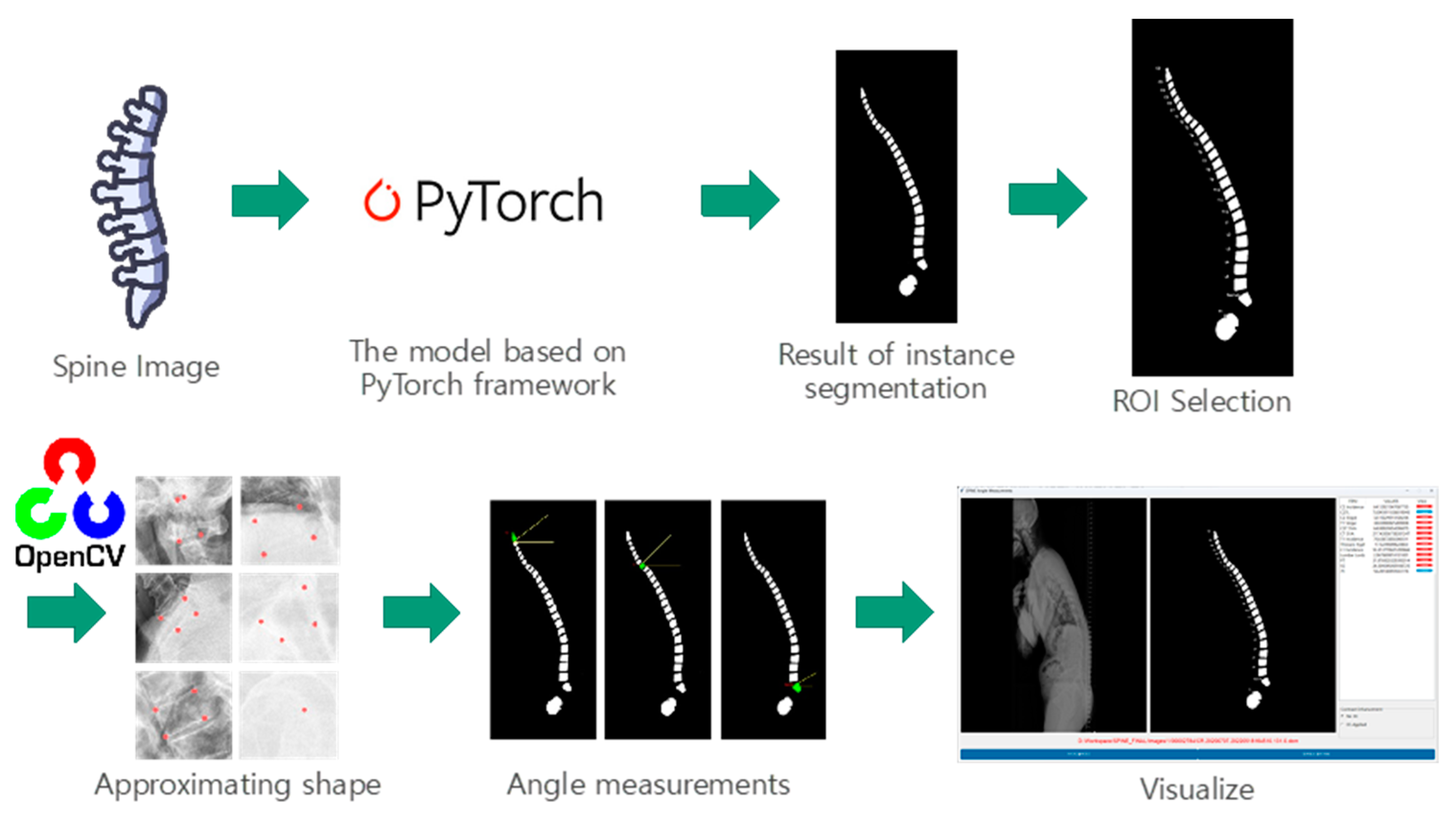 Bioengineering | Free Full-Text | AI-Driven Segmentation and Automated ...