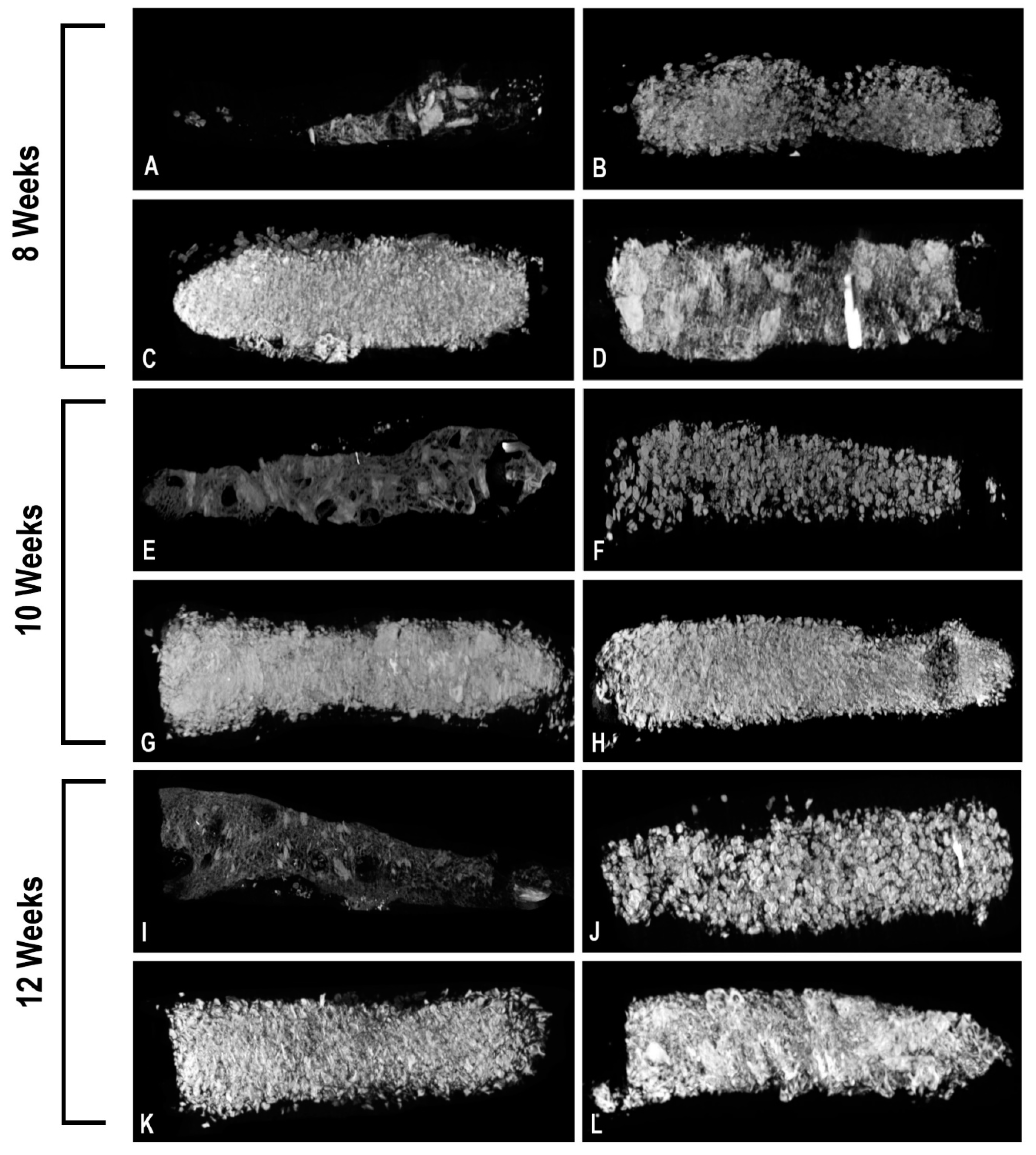 A Comparison of In Vivo Bone Tissue Generation Using Calcium Phosphate ...
