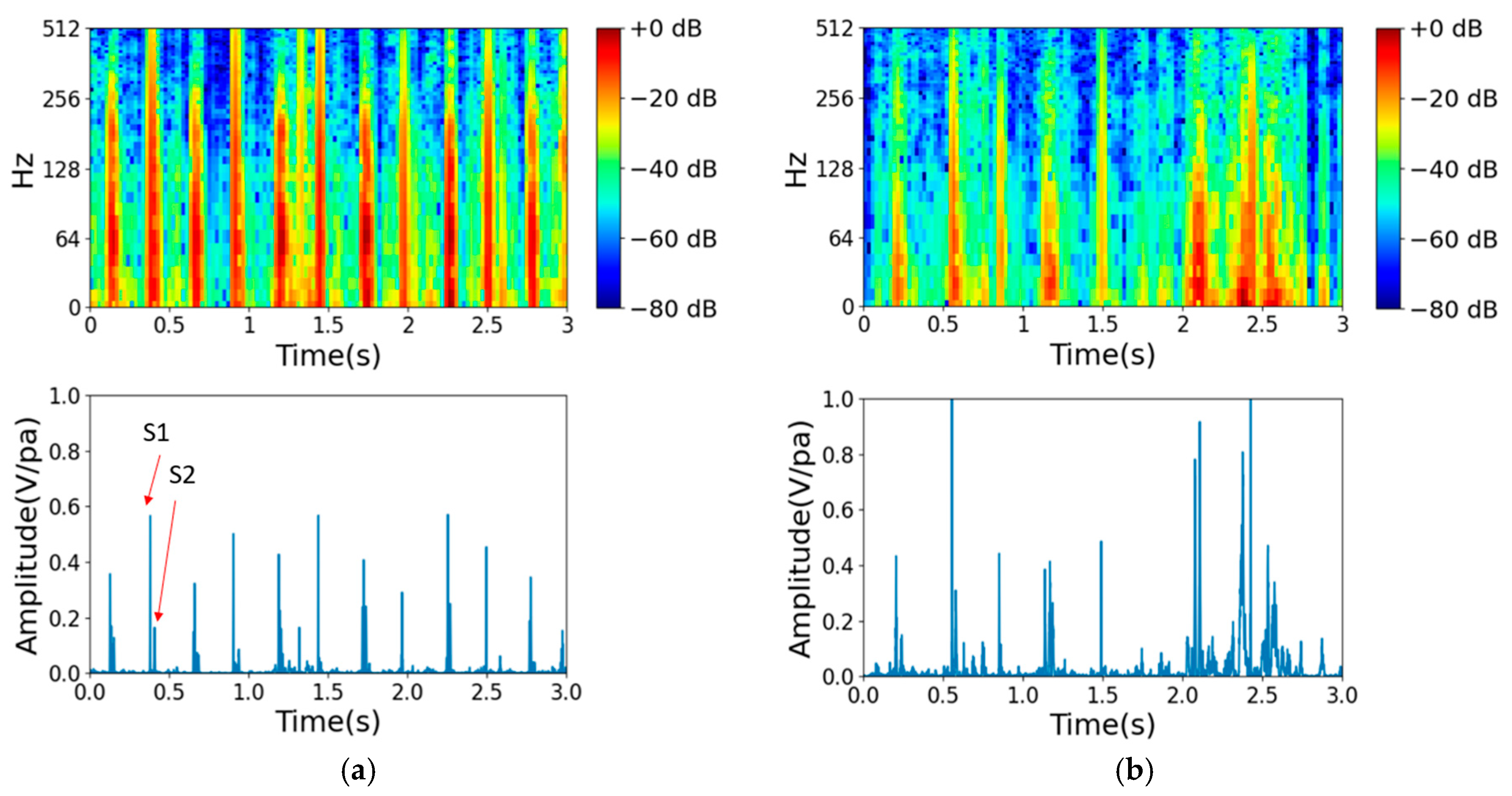 Heart Murmur Classification Using a Capsule Neural Network