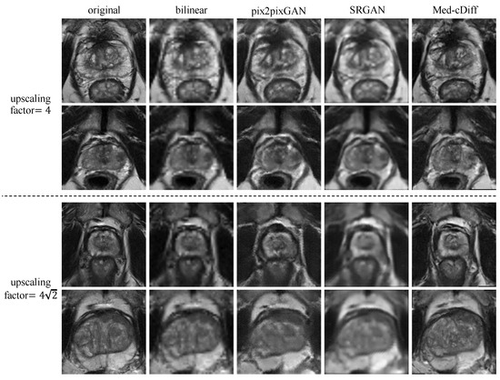 Med-cDiff: Conditional Medical Image Generation with Diffusion Models