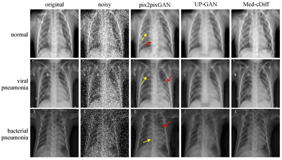 Med-cDiff: Conditional Medical Image Generation with Diffusion Models
