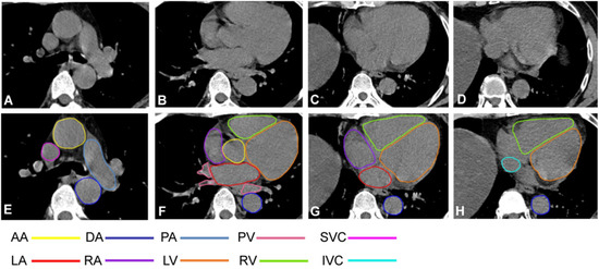Bioengineering | Free Full-Text | Anatomical Prior-Based Automatic ...