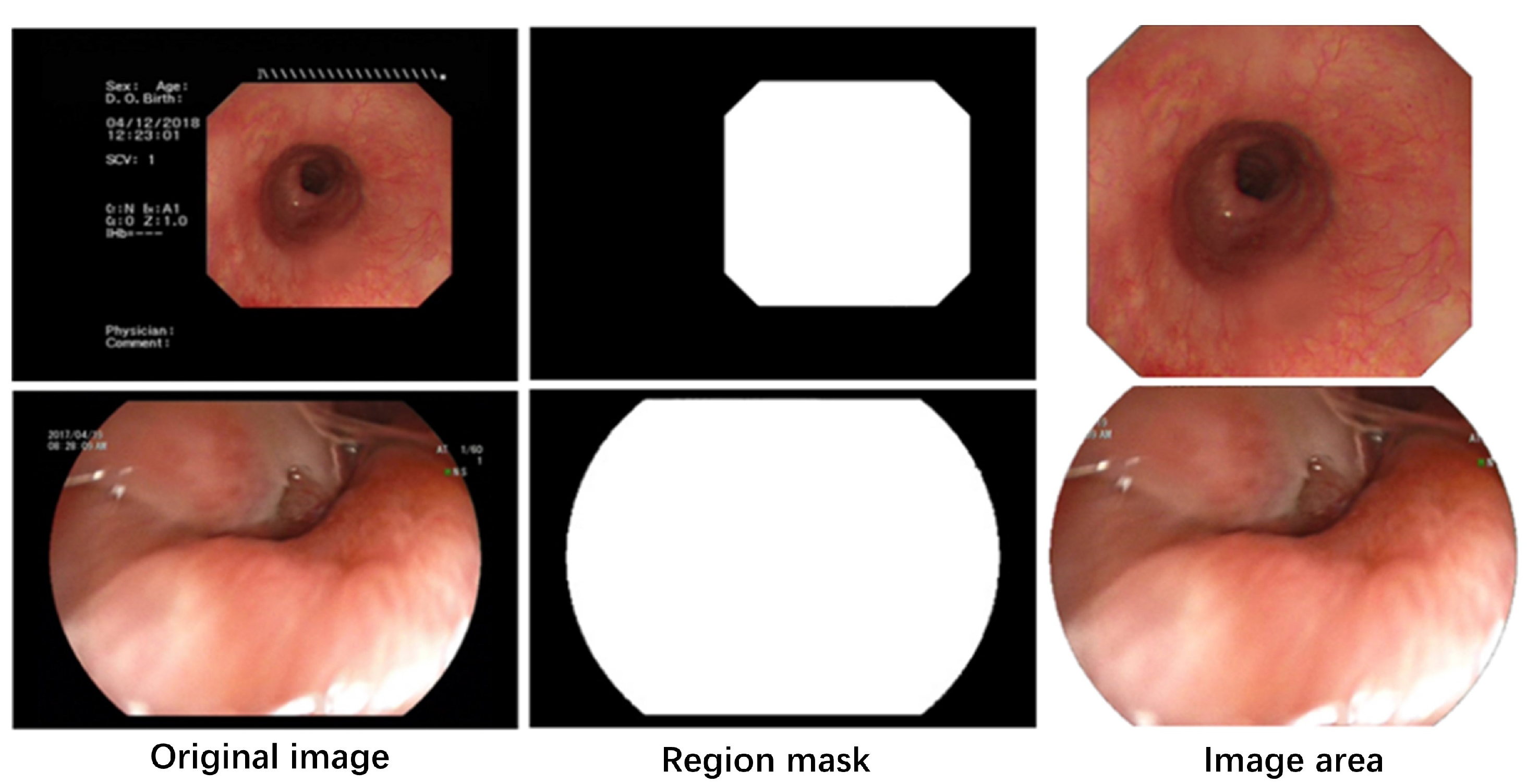 Bioengineering | Free Full-Text | Detection of Image Artifacts Using Improved Cascade Region ...