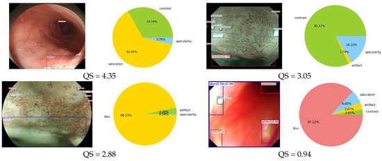Bioengineering | Free Full-Text | Detection of Image Artifacts Using Improved Cascade Region ...
