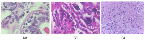 A Comprehensive Review of Computer-Aided Models for Breast Cancer ...