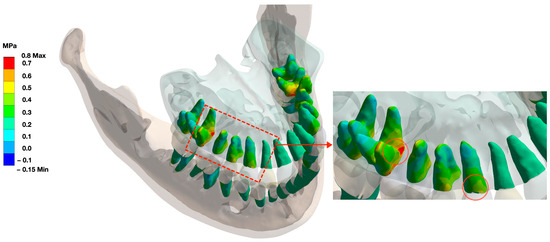 Functional Load Capacity of Teeth with Reduced Periodontal Support: A ...
