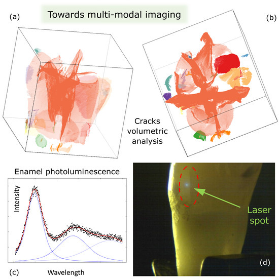 Teeth Microcracks Research: Towards Multi-Modal Imaging