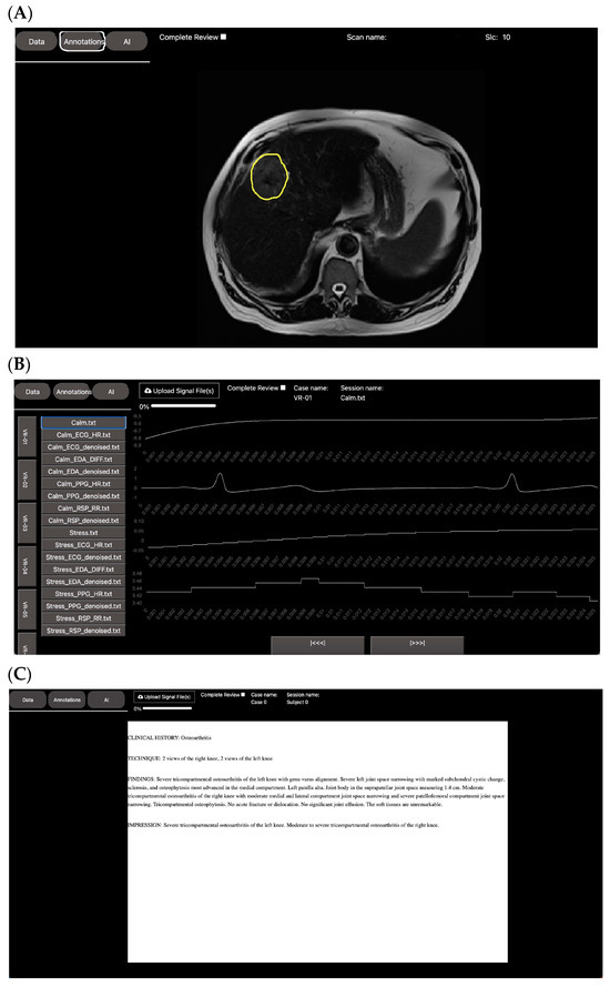 Discovery Viewer (DV): Web-Based Medical AI Model Development Platform ...