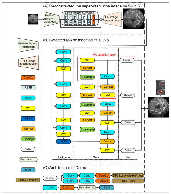An Improved Microaneurysm Detection Model Based on SwinIR and YOLOv8