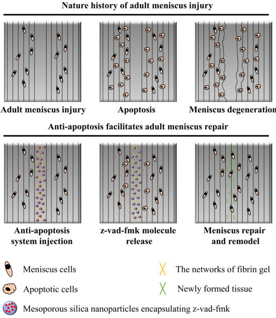 Anti-Apoptosis Therapy for Meniscal Avascular Zone Repair: A Proof-of ...