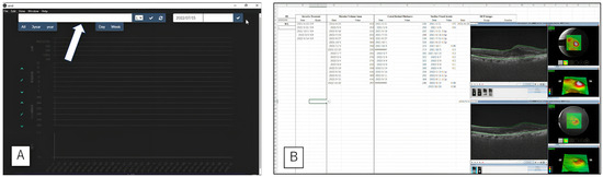 Bioengineering | Free Full-Text | Revolutionizing Patient Monitoring in ...