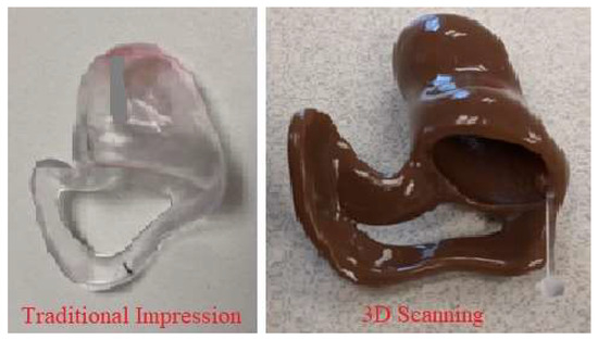 Comparison of Traditional Impression and 3D Ear Scanning Techniques ...