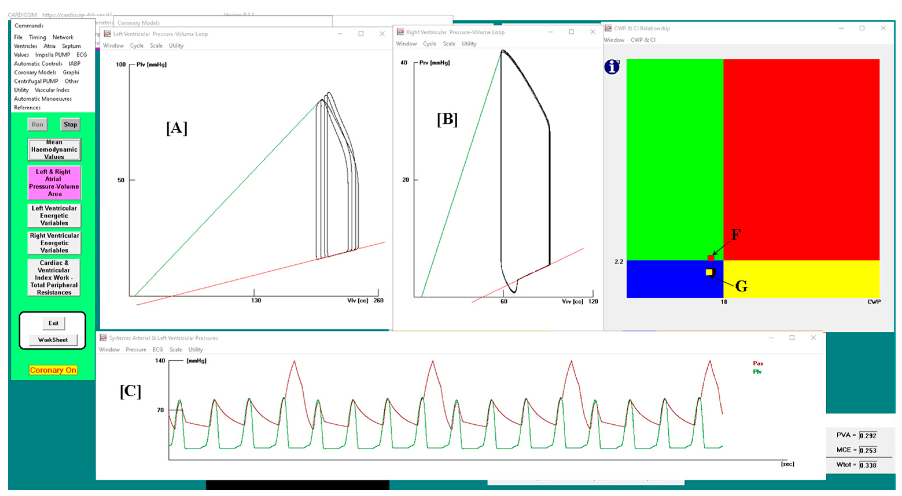 Bioengineering | Free Full-Text | Modelling and Simulation of the ... Bioengineering | Free Full-Text | Modelling and Simulation of the ...