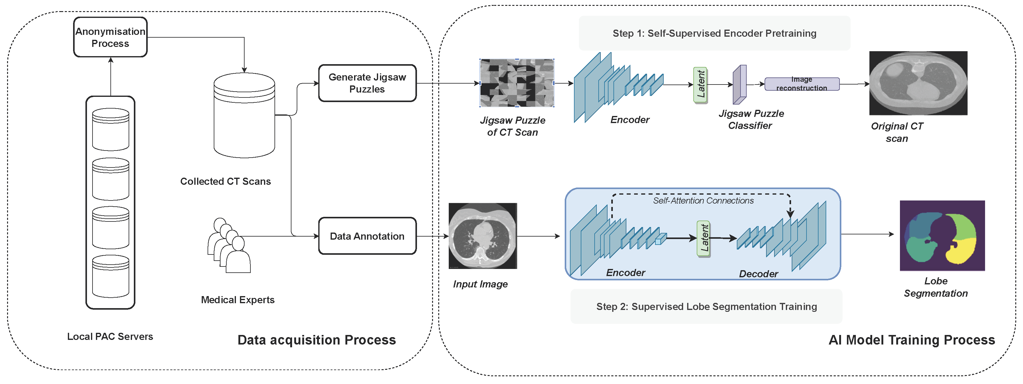Bioengineering | Free Full-Text | Lightweight Techniques to Improve Generalization and ...
