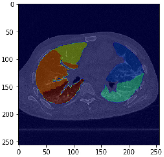 Bioengineering | Free Full-Text | Lightweight Techniques to Improve ...