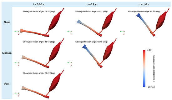 A Biomechanical Simulation of Forearm Flexion Using the Finite Element ...