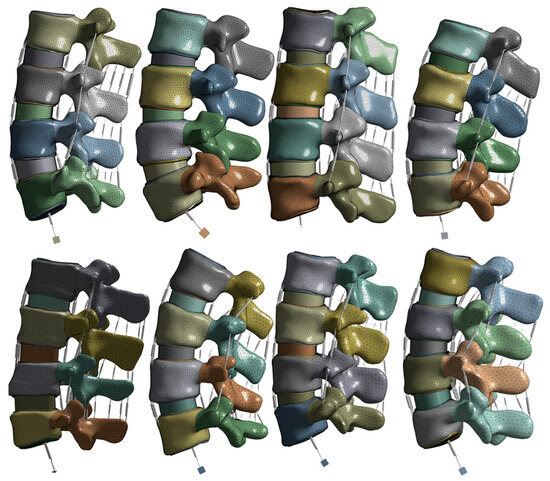 Inter-Specimen Analysis of Diverse Finite Element Models of the Lumbar ...