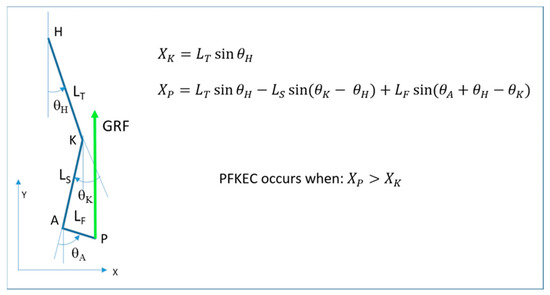 Control of Tibial Advancement by the Plantar Flexors during the Stance ...