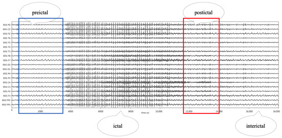 Time-Series Anomaly Detection Based on Dynamic Temporal Graph ...