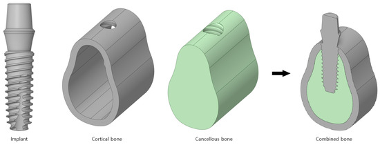 Toward Digital Twin Development for Implant Placement Planning Using a ...