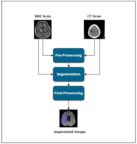 Bioengineering | Free Full-Text | Stroke Lesion Segmentation and Deep ...