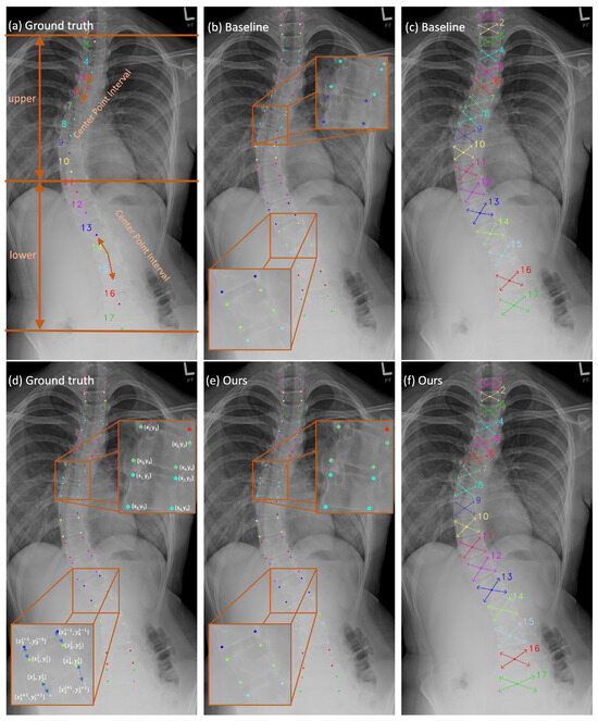 Bioengineering | Free Full-Text | A Dual Coordinate System Vertebra Landmark Detection Network ...