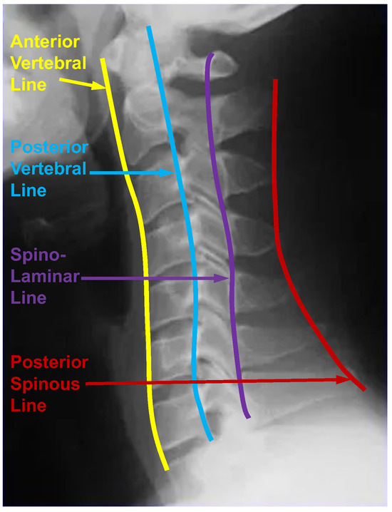 A Dual Coordinate System Vertebra Landmark Detection Network with ...
