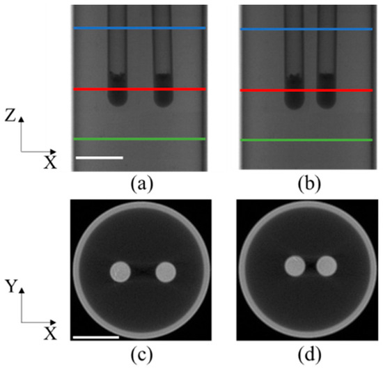 Automated Restarting Fast Proximal Gradient Descent Method for Single-View Cone-Beam X-ray ...