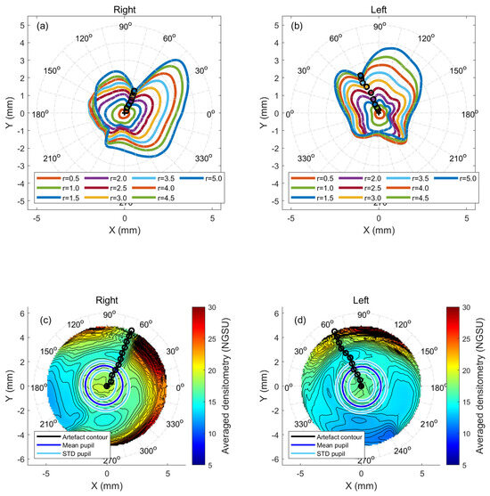 Investigation of How Corneal Densitometry Artefacts Affect the Imaging ...