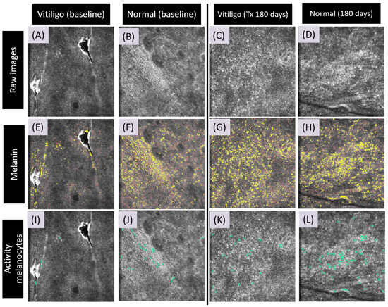 Feasibility of High-Cellular-Resolution Full-Field, Artificial ...
