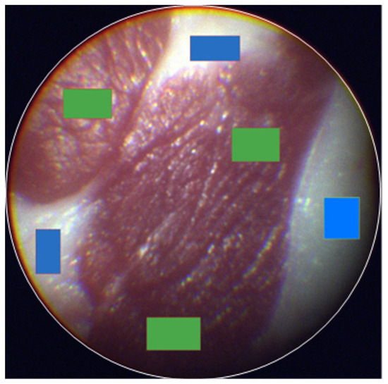 Endoscopic Hyperspectral Imaging System to Discriminate Tissue ...