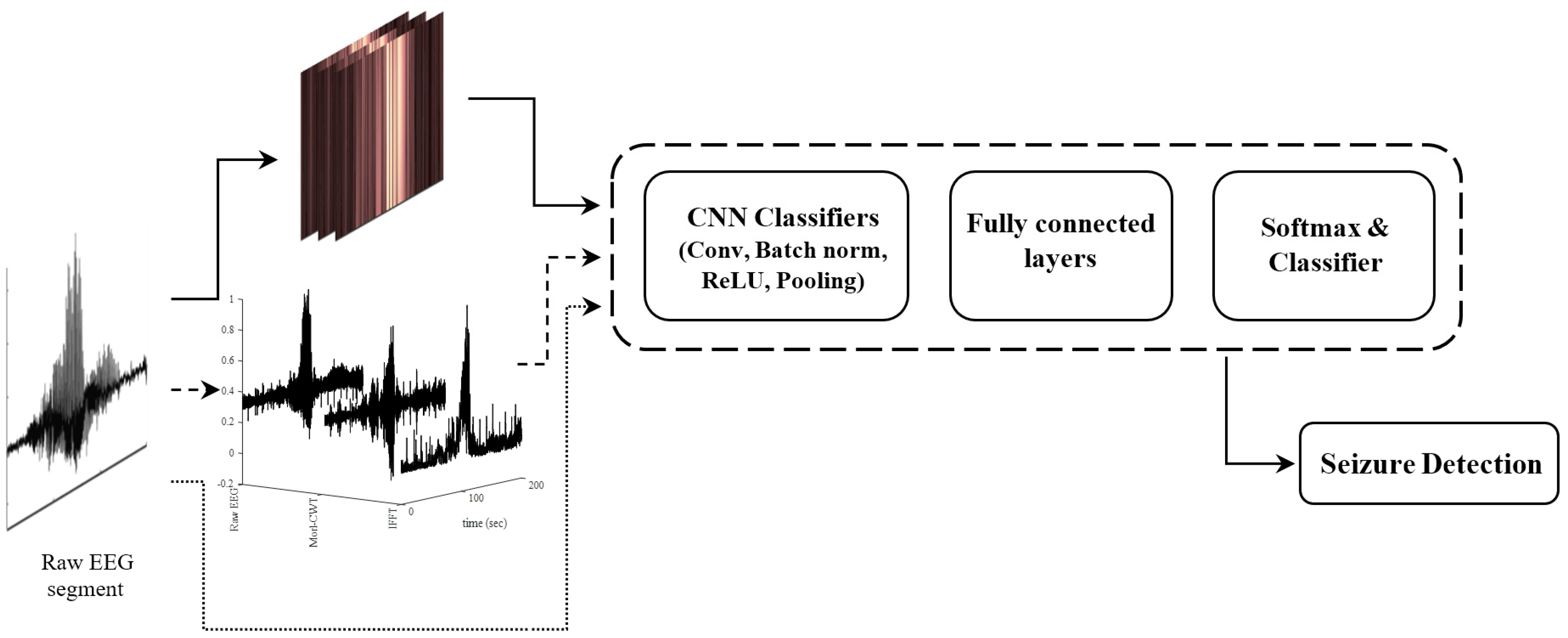 Deep Learning for Generalized EEG Seizure Detection after Hypoxia ...