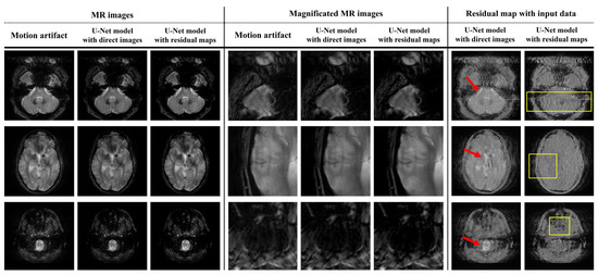 Bioengineering | Free Full-Text | Motion Artifact Reduction Using U-Net Model with Three ...